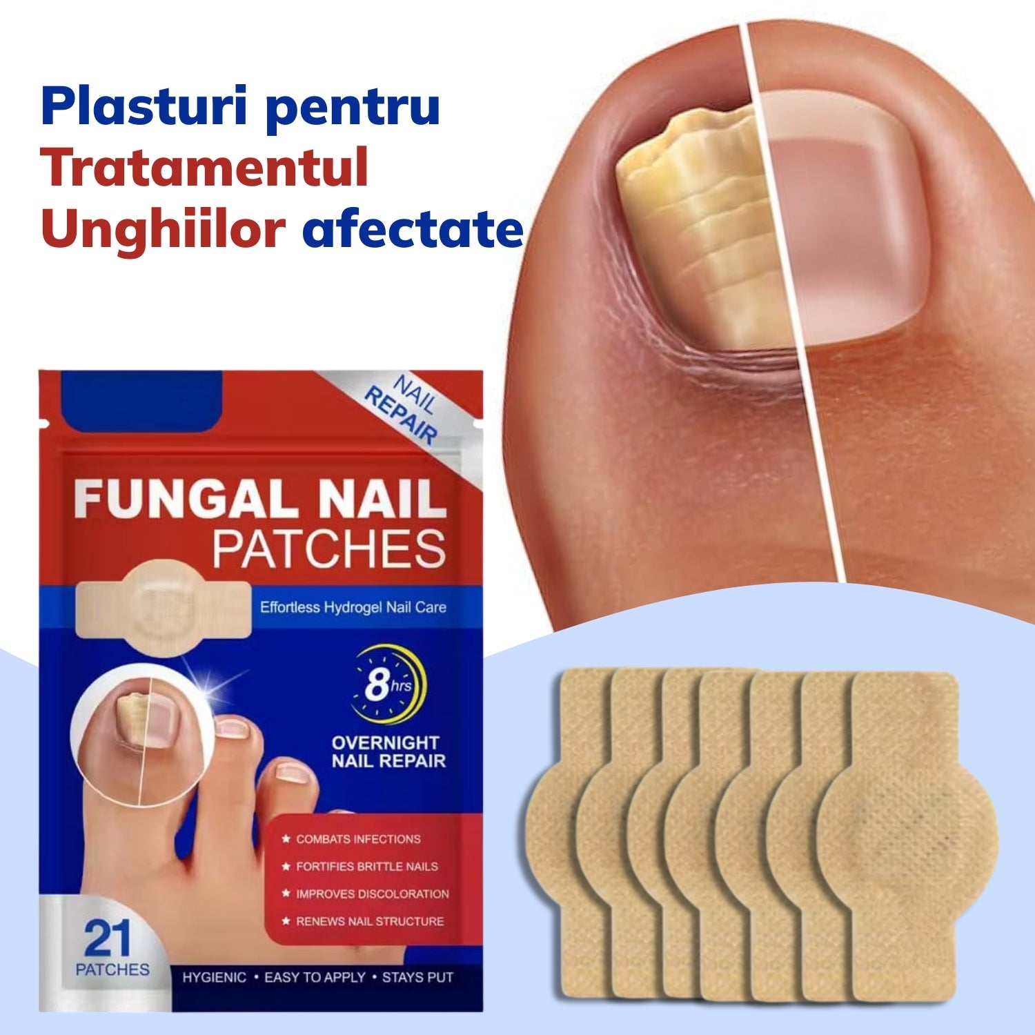 Plasturi pentru tratamentul unghiilor MycoStop – LivraMAG.ro